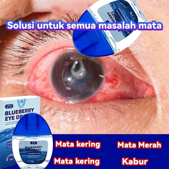 Obat Mata Berlemak Kekuningan Penyakit Pterigium Glukoma Katarak Ada ...