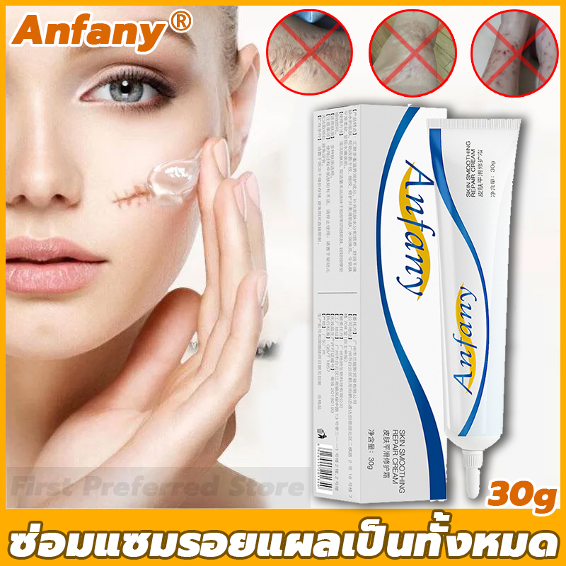 Anfany ครีมทารอยแผลเป็น 30g ครีมบำรุงและดูแลรอยแผลเป็น ลบรอยแผลเป็นอย่างรวดเร็ว น้ำร้อนลวก แผลไฟ ...