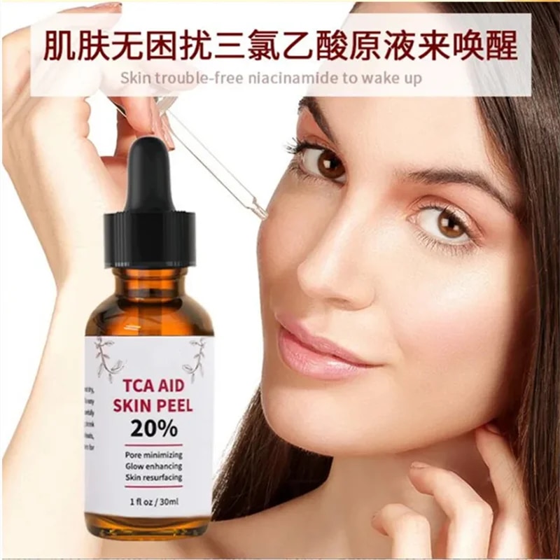 【Big savings】 20% TCA aid skin peel pores 30ml trichloroacetic acid ...