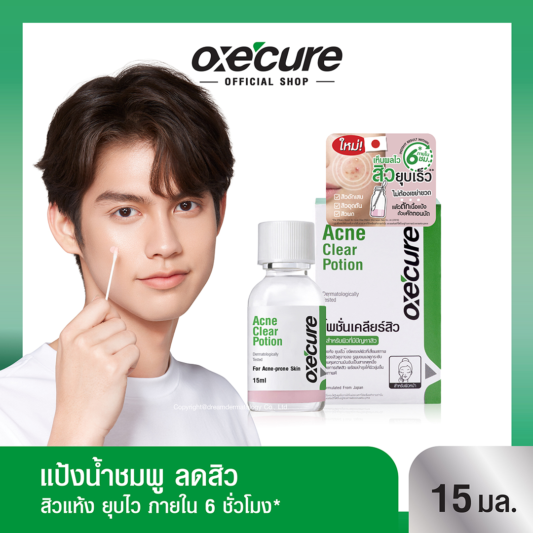 [SET] Oxecure Acne Care Duo ดูแลปัญหาสิวสำหรับผิวหน้า แป้งน้ำลดสิว ...
