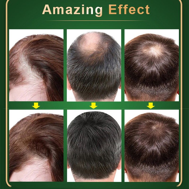 Original Thailand Neo Hair Lotion Paradise 120ml Hair Growth Oil ...