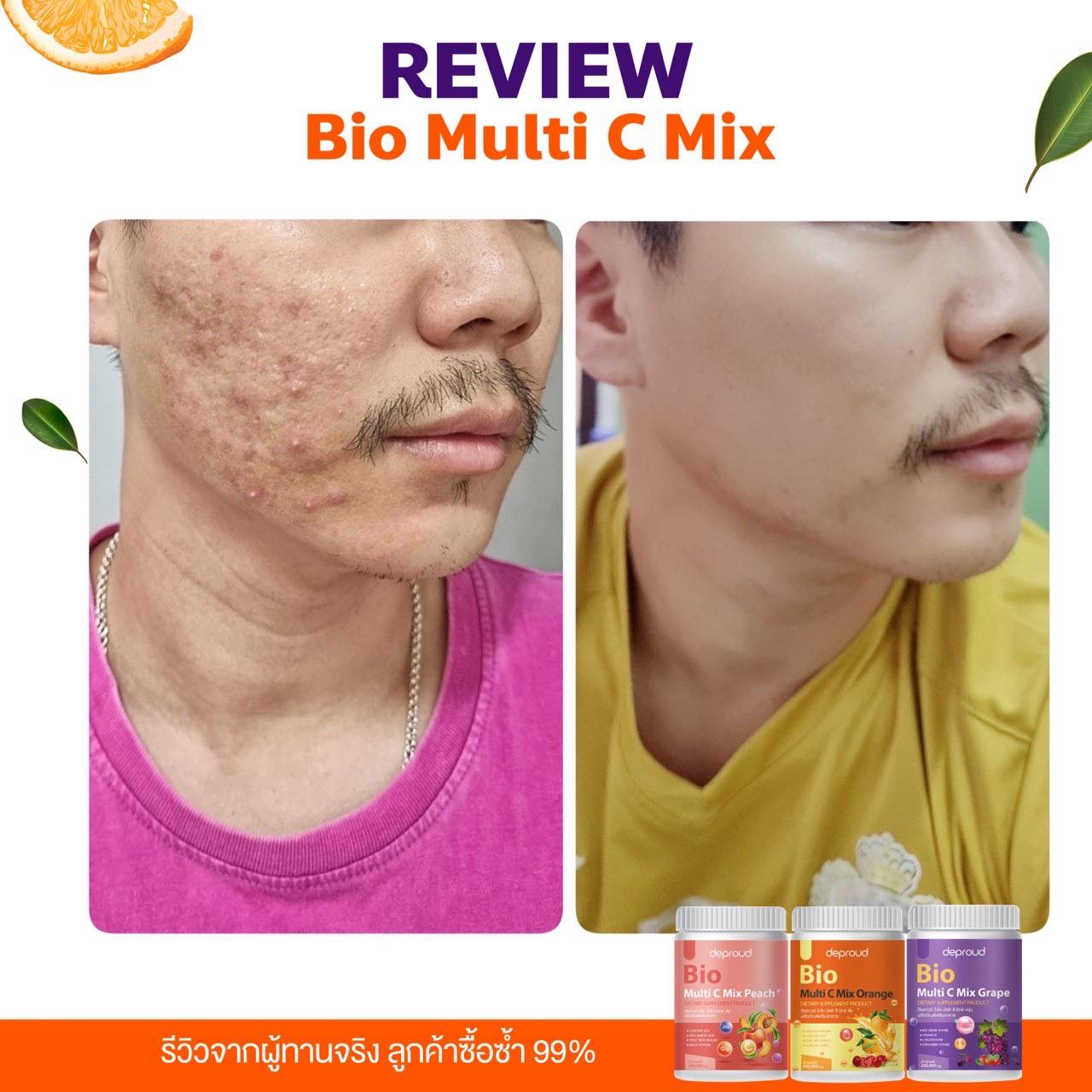 1 กระปุก Deproud Bio Multi C Mix ดีพราวด์วิตามินซีสด 3 สูตรส้มพีชองุ่น 250 g. Multi Colly Plus ...