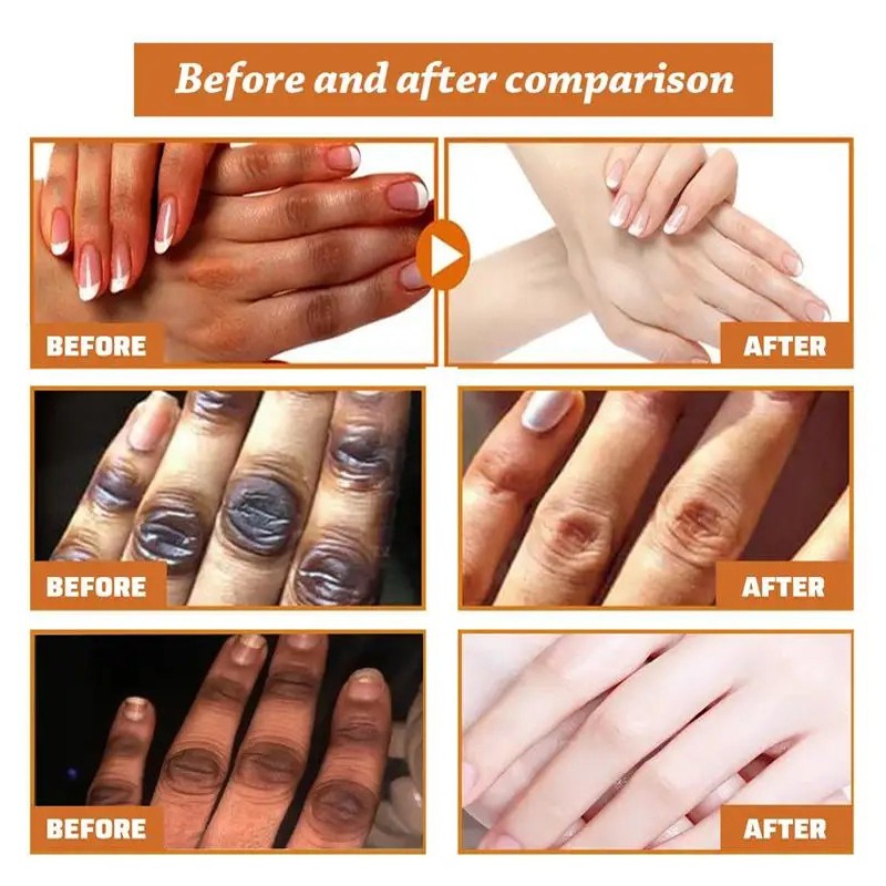 Quickly Brightening Cream For Dark Skin Brighten Intimate Areas Armpit ...