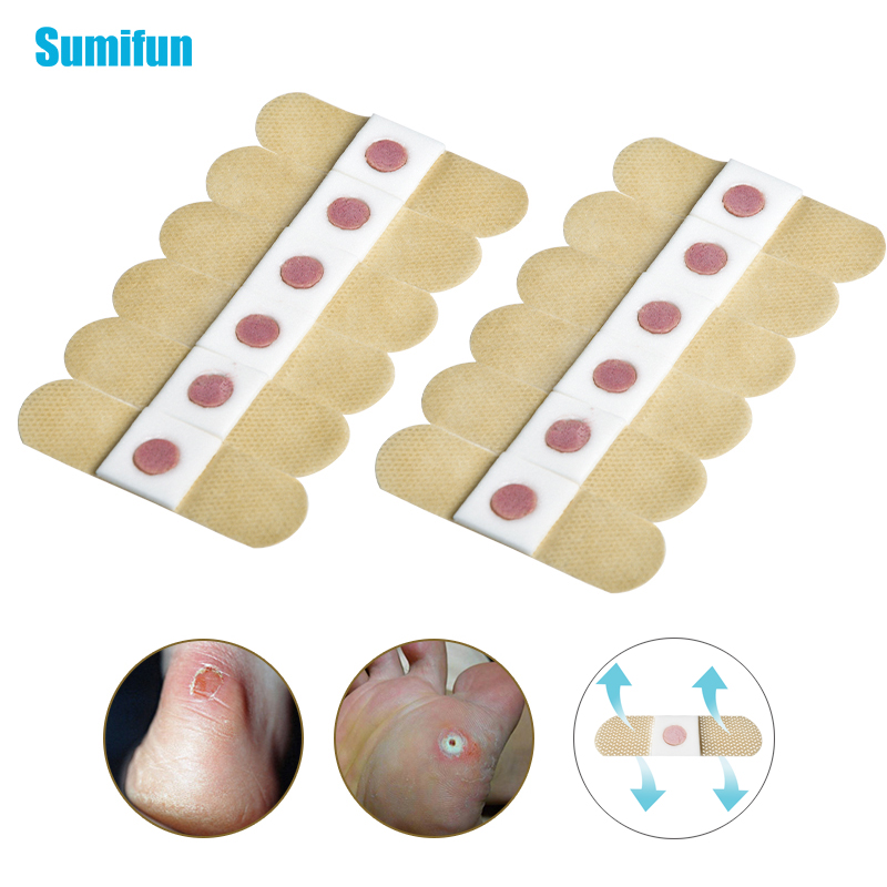 【TrendGlobe】36Pcs Foot Corn Removal Plaster Calluses Plantar Warts ...