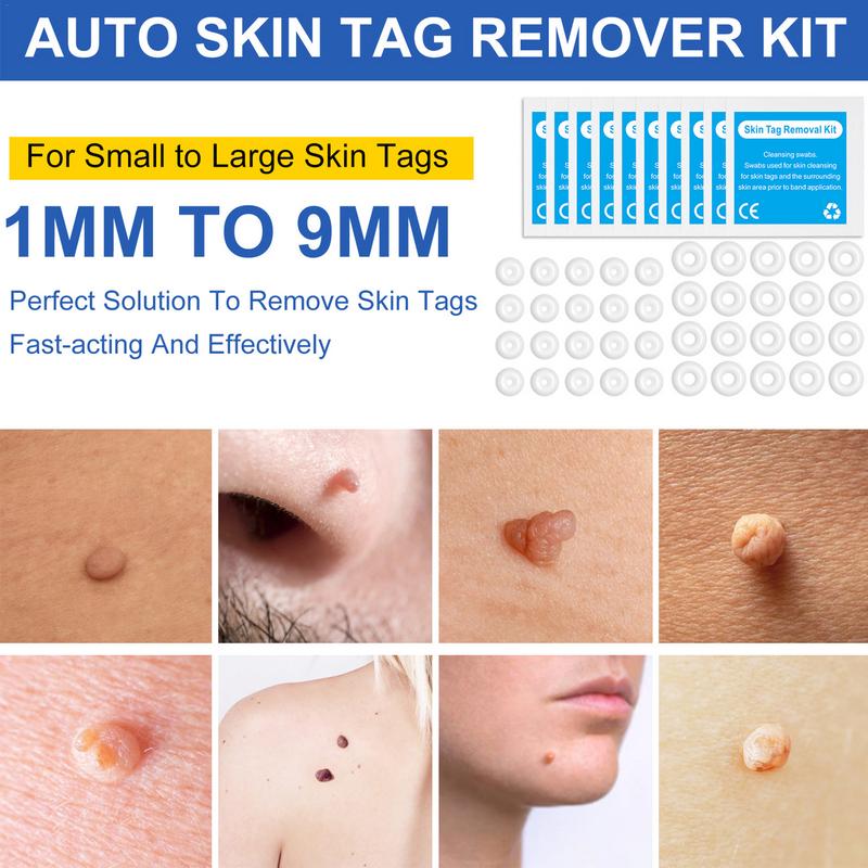 Remove Skin Tags Skin Tags Removal Tool With Two Cones 2mm 9mm Wart ...