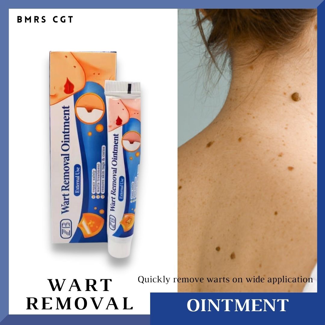ORIGINAL Warts Removal Ointment | NO PAIN WARTS ALL SKIN TYPES Organic ...