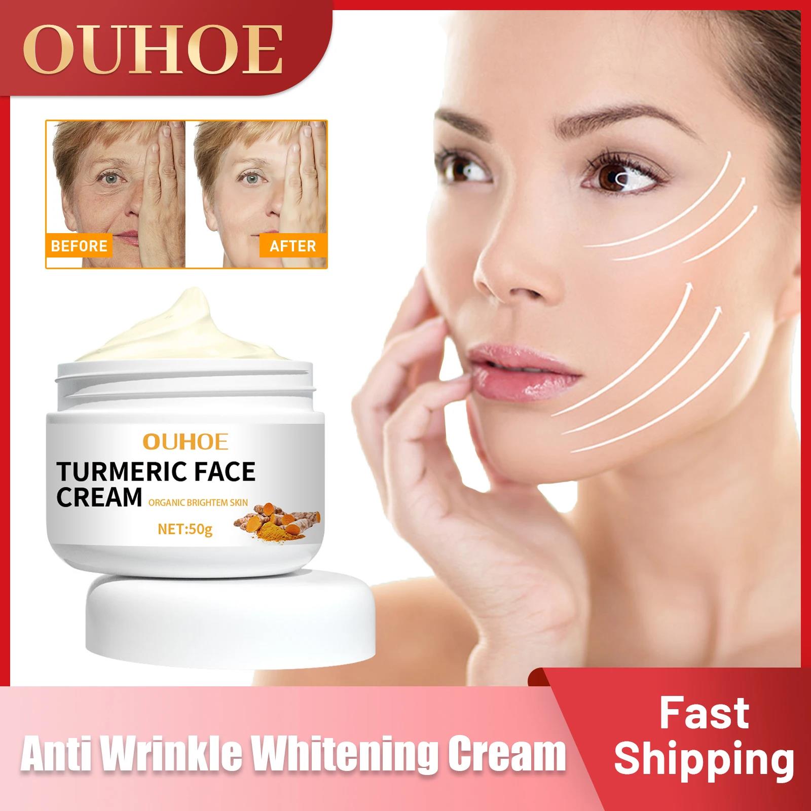 Turmeric Whitening Cream Original Dark Spot Correcting Melasma Freckle ...