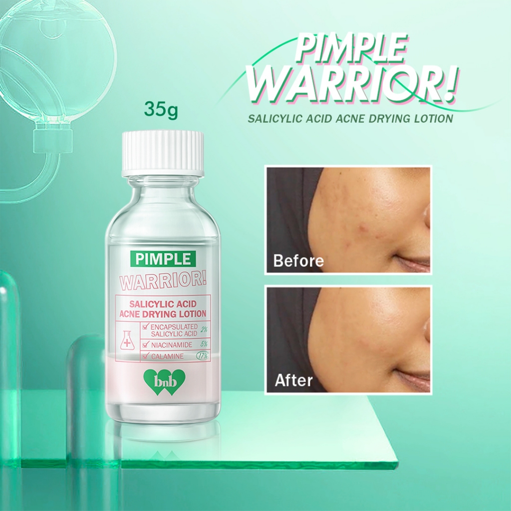 HOT SALES 】 BNB barenbliss Pimple Warrior Salicylic Acid Acne Drying ...