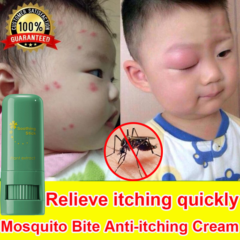 Mosquito Bite Anti-itching Cream Prevent Mosquito Bites Safe for Kids ...