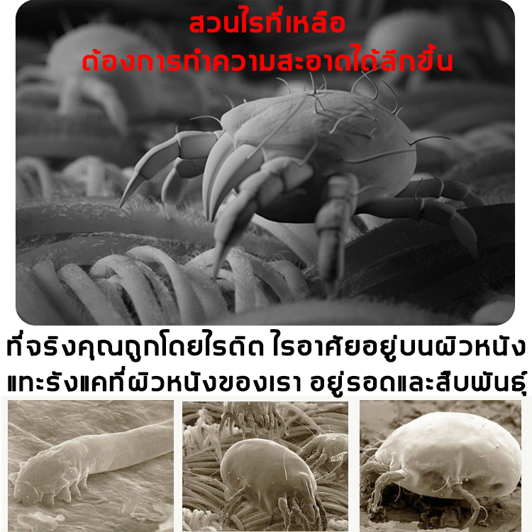 สบู่กำจัดสิว ZILIN สบู่ลดสิวหน้า 100g (สบู่ล้างหน้าใส สบู่ลดรอยสิว สบู่ ...