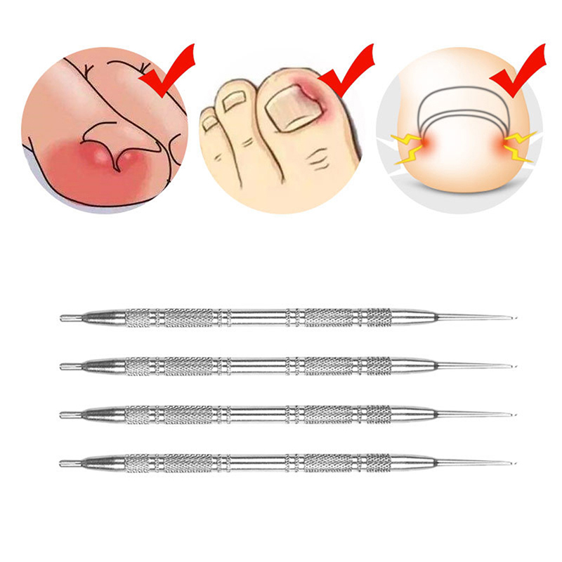 Toe Nail File Foot Hook Ingrown Toe Correction Lifter Pedicure Toenails ...