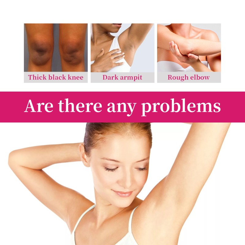 TAHANgTA Hot Selling Underarm Bleaching Whitening Cream Serum Leg Knee ...