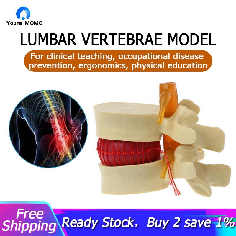 Lumbar Vertebrae Model Anatomical Spine Lumbar Disc Herniation Anatomy ...