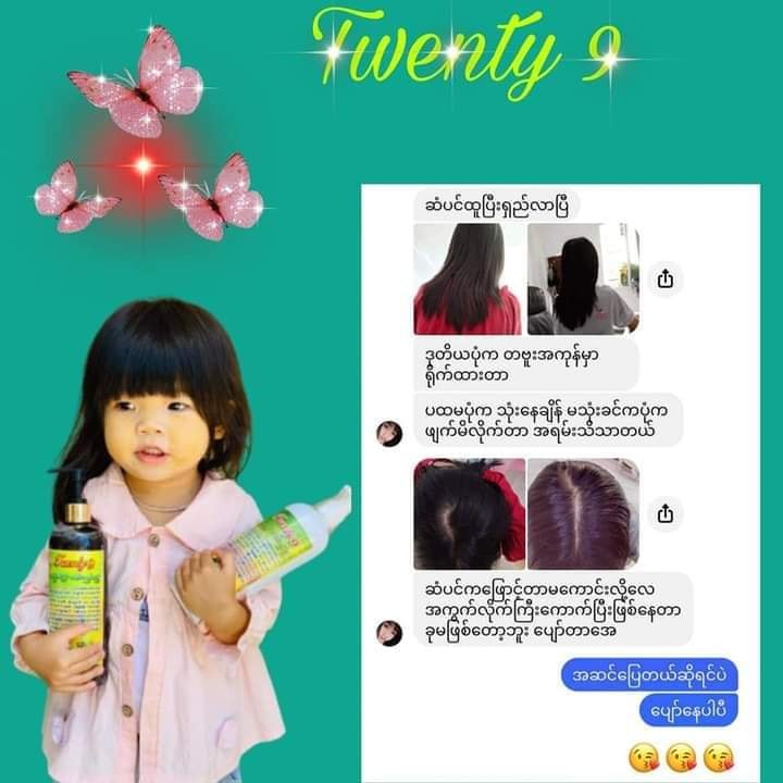 Twenty 9 Shampoo (တေရာ္ကင္ပြန္းေခါင္းေလွ်ာ္ရည္) - Myanmar Books Store ...