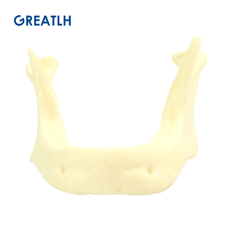 【High-quality】Dental Lower Jaw Model Mandibular Implant Model Dental ...