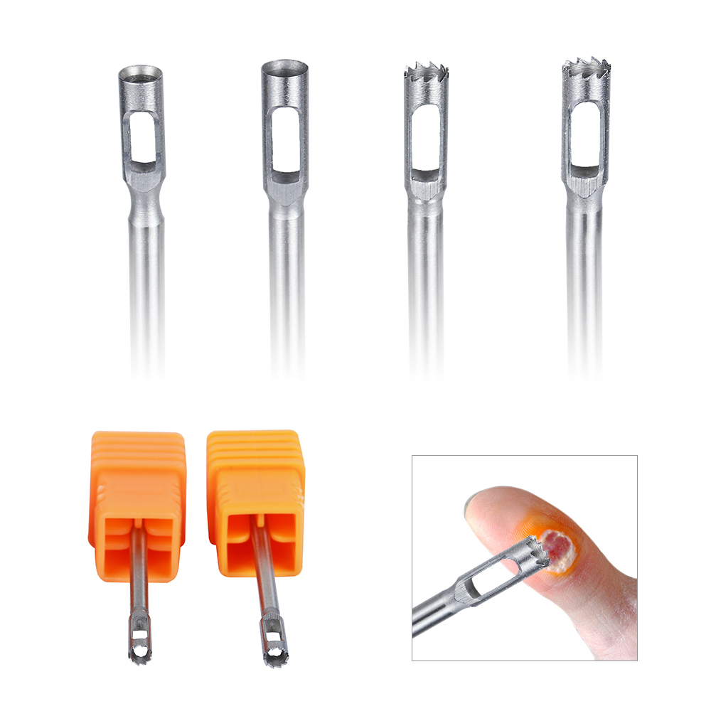 【The road to happiness Store】Stainless steel Medical Pedicure Faster ...