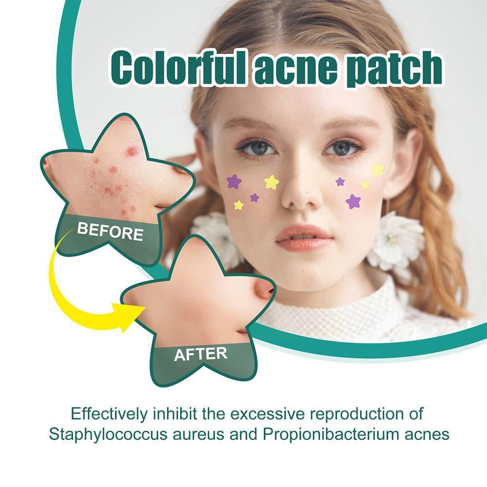 New Star Pimple Patch Stickers Dazzling Colorful Face Acne Removal Skin ...
