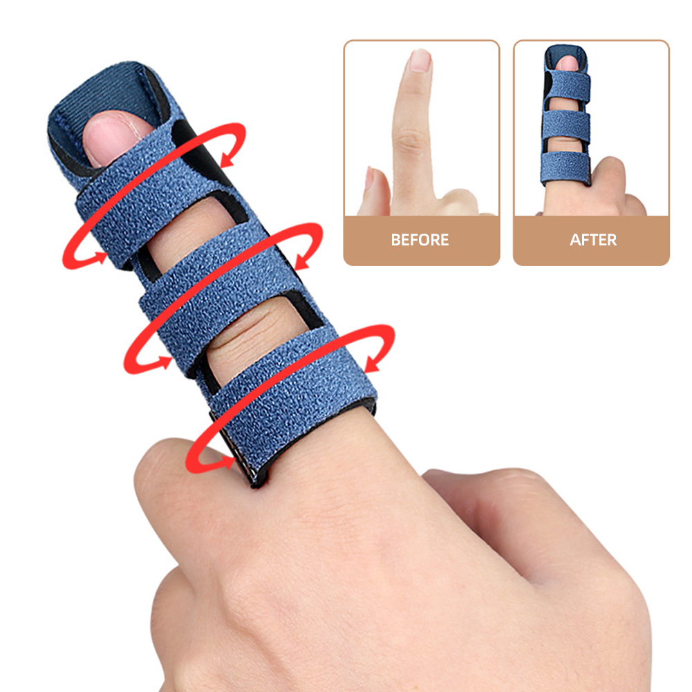 FG Finger Fixed Strap Aluminum Strip Fixed Support Strap Adjustable ...