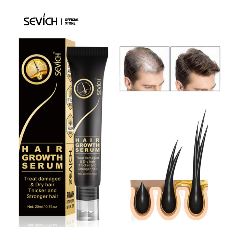 Sevich Scalp Massage Roller Hair Growth Oil Thickener Ginger Essence Anti Hair Loss Treatments