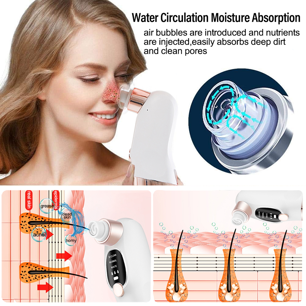 Blackhead Remover Pore Vacuum Suction Face Cleaner USB Rechargeable ...