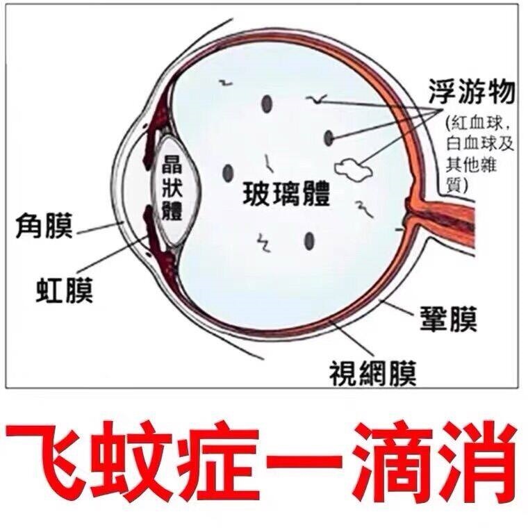 eye dropJin Shi Jian eye cold compress gel 13ml drops Cool Eye Drops ...