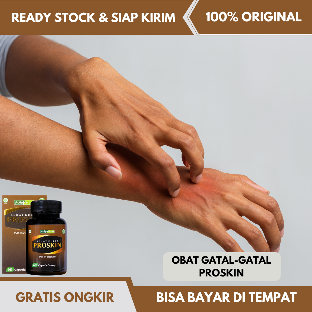 Obat Gatal-Gatal, Obat Gatal Kulit, Gatal Selangkangan Berjamur, Kurap ...
