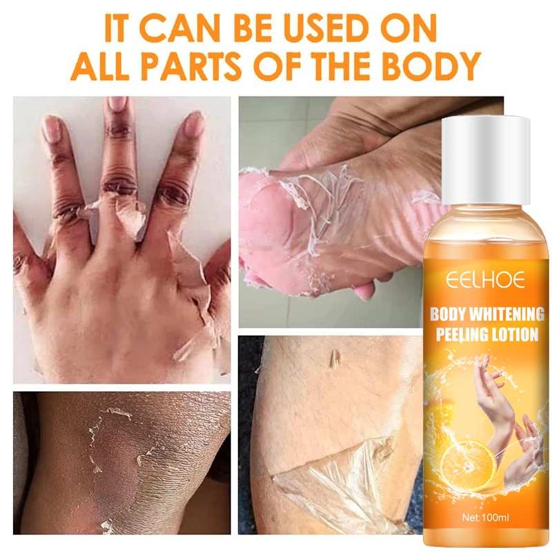 Body Yellow Peeling Oil Orange Essence Skin Whitening Hand Bleaching ...