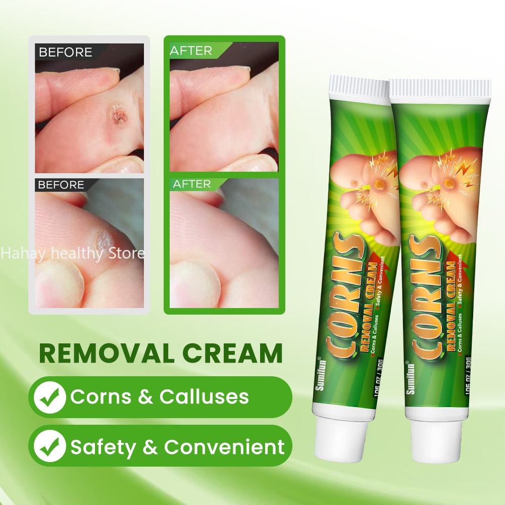 Foot Corn Remover Cream Chicken Eye Skin Infection Treatment Ointment ...