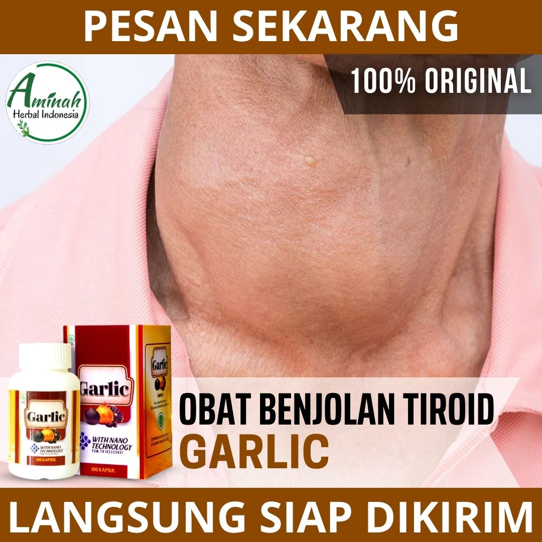 Obat Tiroid Bengkak - Obat Penyakit Tiroid, Obat Nodul Tiroid, Obat ...