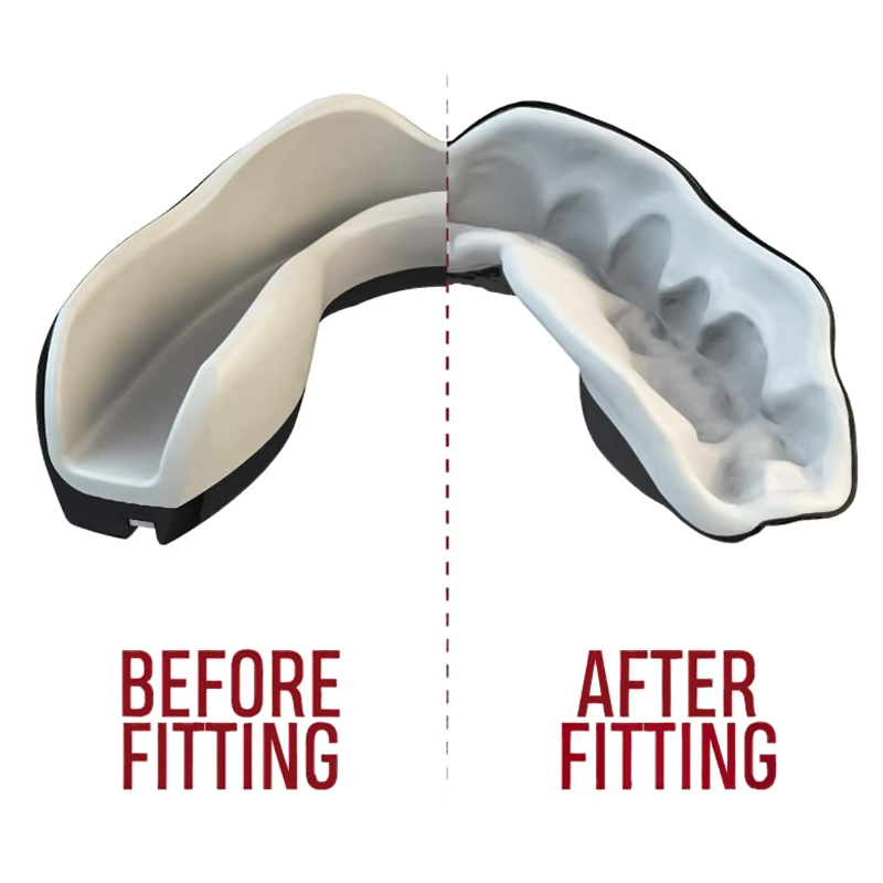 【SmartHorizon】Sports Mouth Guard Teeth Protector Adults Junior EVA ...
