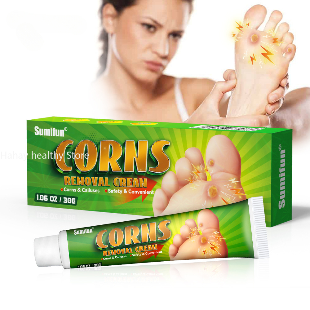 Foot Corn Remover Cream Chicken Eye Skin Infection Treatment Ointment ...
