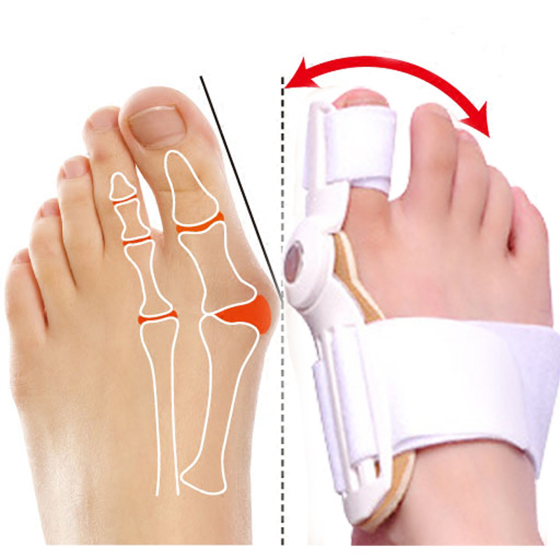 1Pcs Hallux Valgus Splint Correction Separator Finger Bicyclic Bunion ...