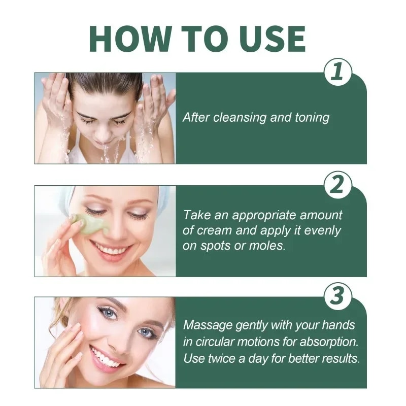 Anti freckle cream fade spots pimple improve dull Melanin remove Acne ...