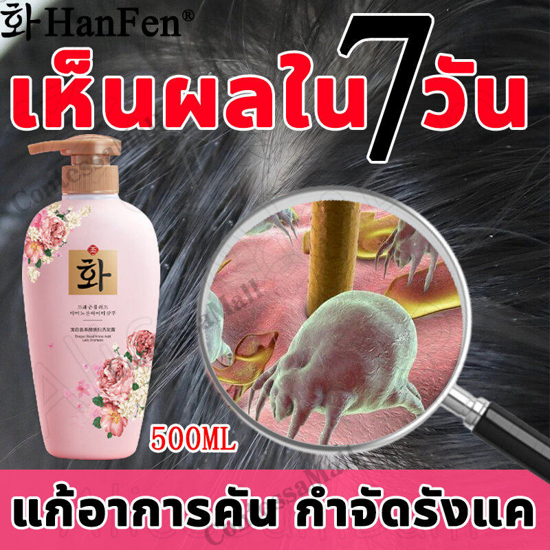 【มีประสิทธิภาพการกำจัดไร】HANFEN แชมพู เจลอาบน้ำ ขจัดรังแค ป้องกันอาการ ...