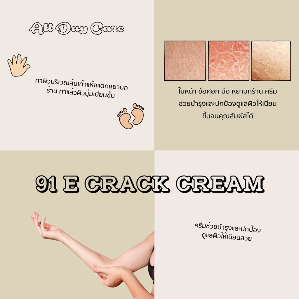 ครีมทาส้นเท้าแตก ครีม 91 อี Cream 91E กล่องละ 8.3 กรัม - KMIST - ThaiPick
