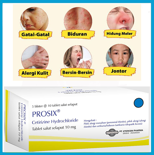 Prosix Obat Gatal | Anti Alergi | Ruam Kulit | Biduran 1 Strip | Lazada ...