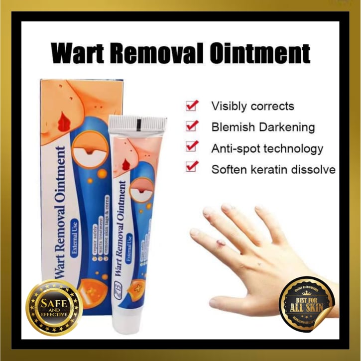 ORIGINAL Wart Removal Ointment Wart Treatment Cream Neck Skin Tag ...