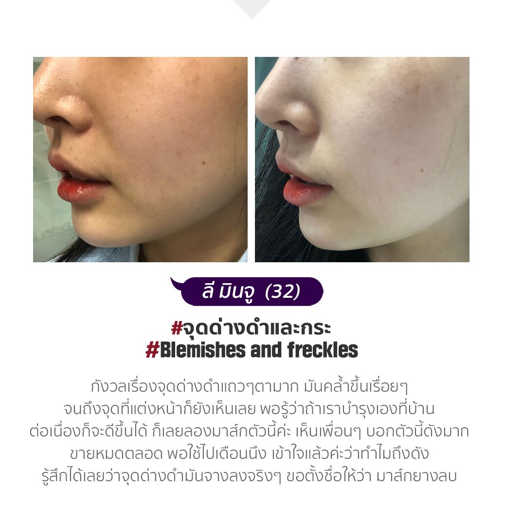 พร้อมส่งด่วน !!! ส่งฟรี ????PROBIOTIC ILDONG FIRSTLAB PROBIOTIC MASK 1 ...