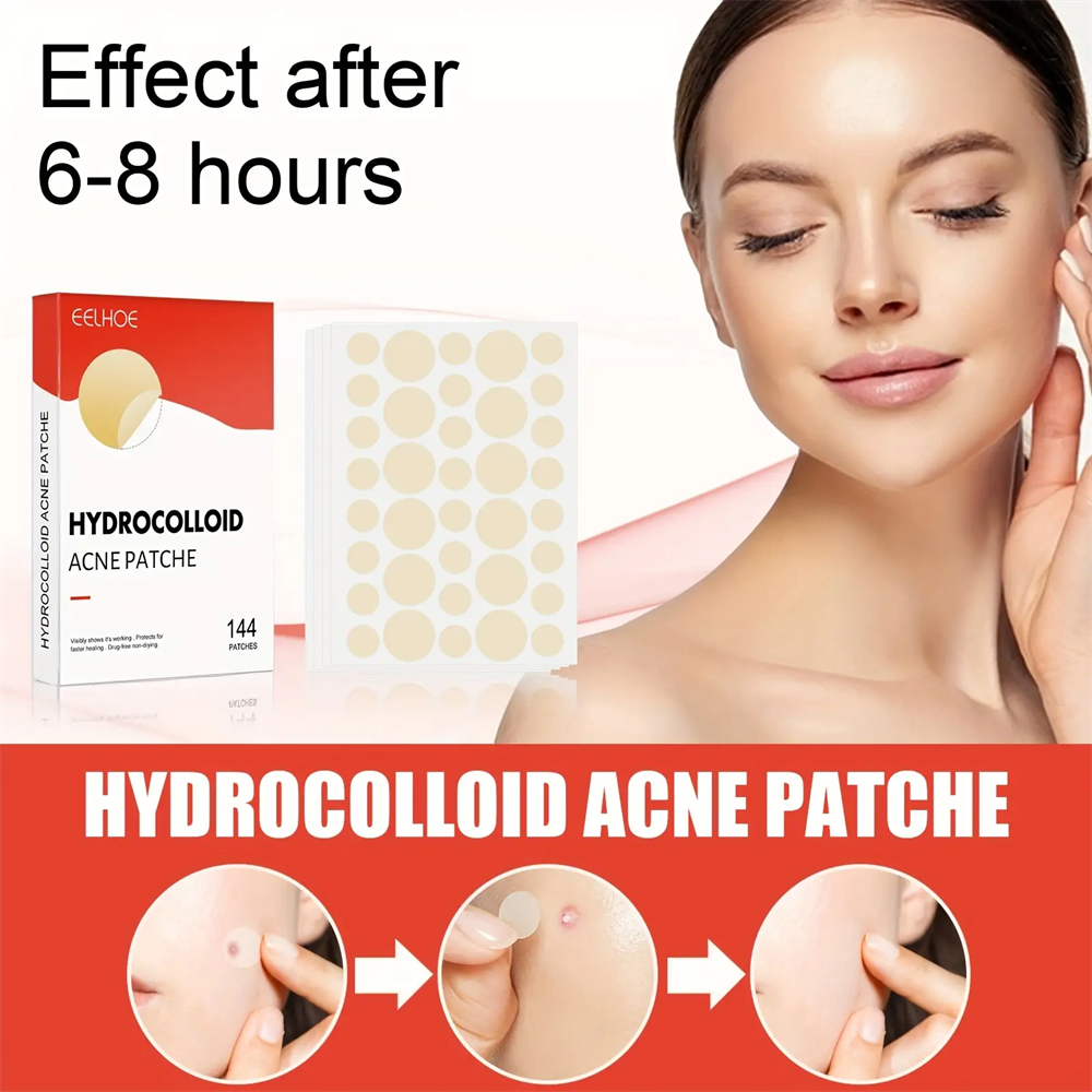 Acne Pimple Patches (144 Stick), Hydrocolloid Acne Patches with Tea ...