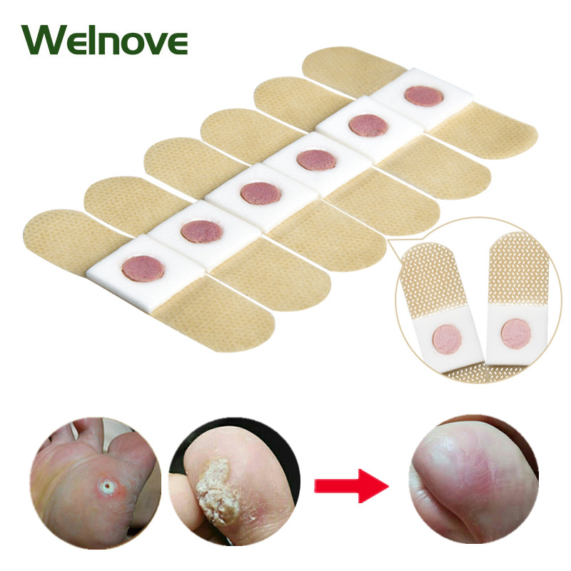 【TrendGlobe】24pcs Foot Corn Killer Pads Removal Calluses Plantar Warts ...
