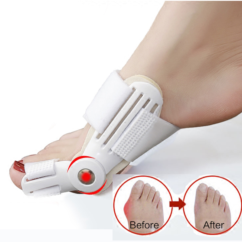 1Pcs Hallux Valgus Splint Correction Separator Finger Bicyclic Bunion ...