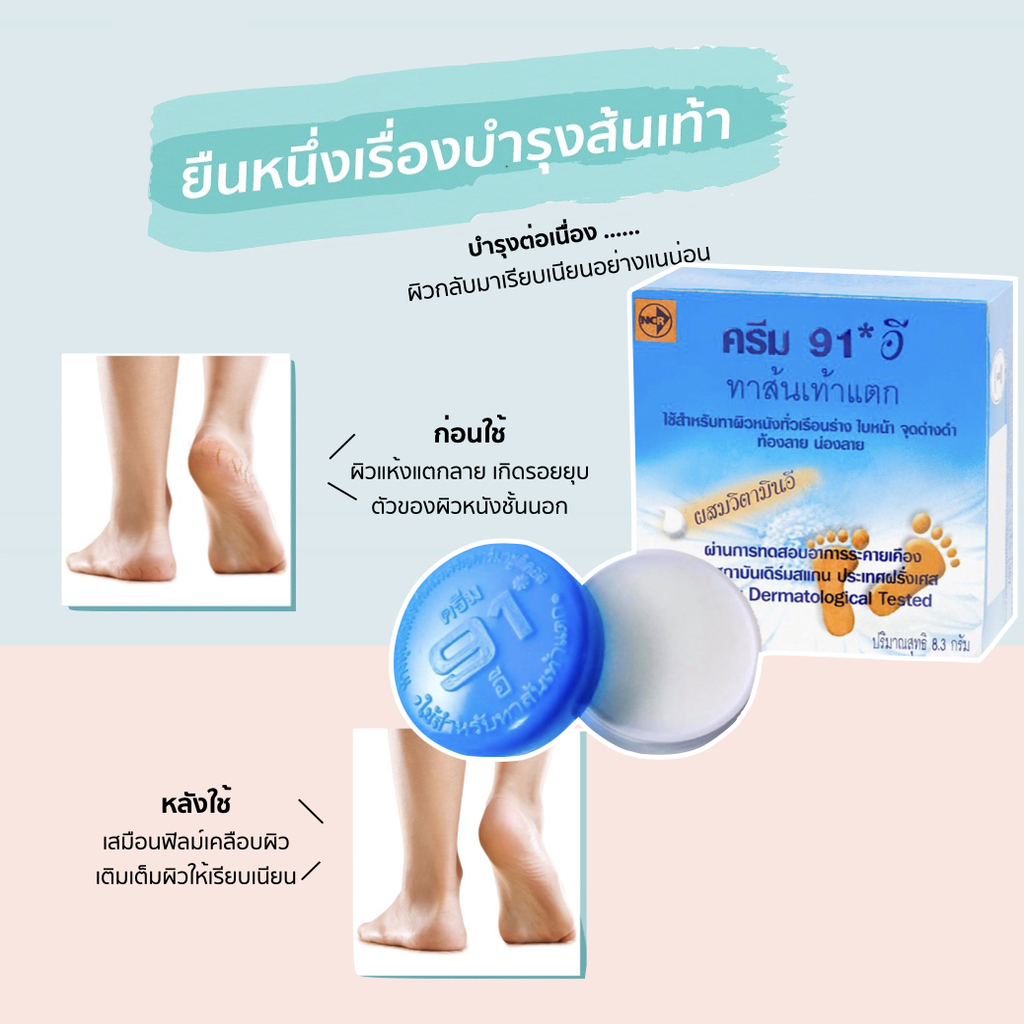 ครีมทาส้นเท้าแตก ครีม 91 อี Cream 91E กล่องละ 8.3 กรัม - KMIST - ThaiPick