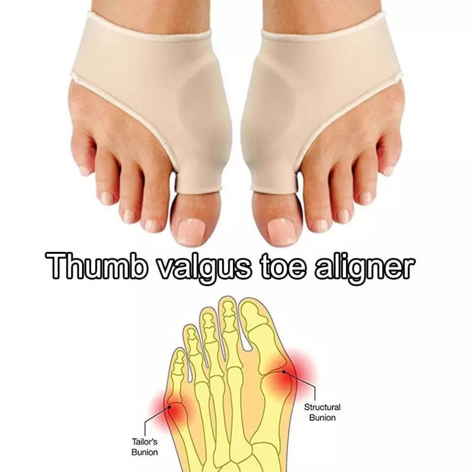 INSOLE UNTUK HALLUX VALGUS BUNION JARI KAKI BENGKOK KOREKTOR HALLUX ...