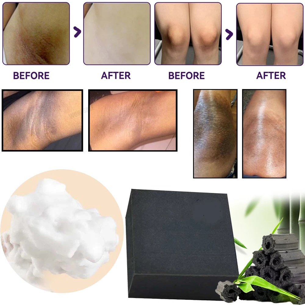 100g Bamboo Charcoal Handmade Soap Treatment Skin Care Natural Skin ...