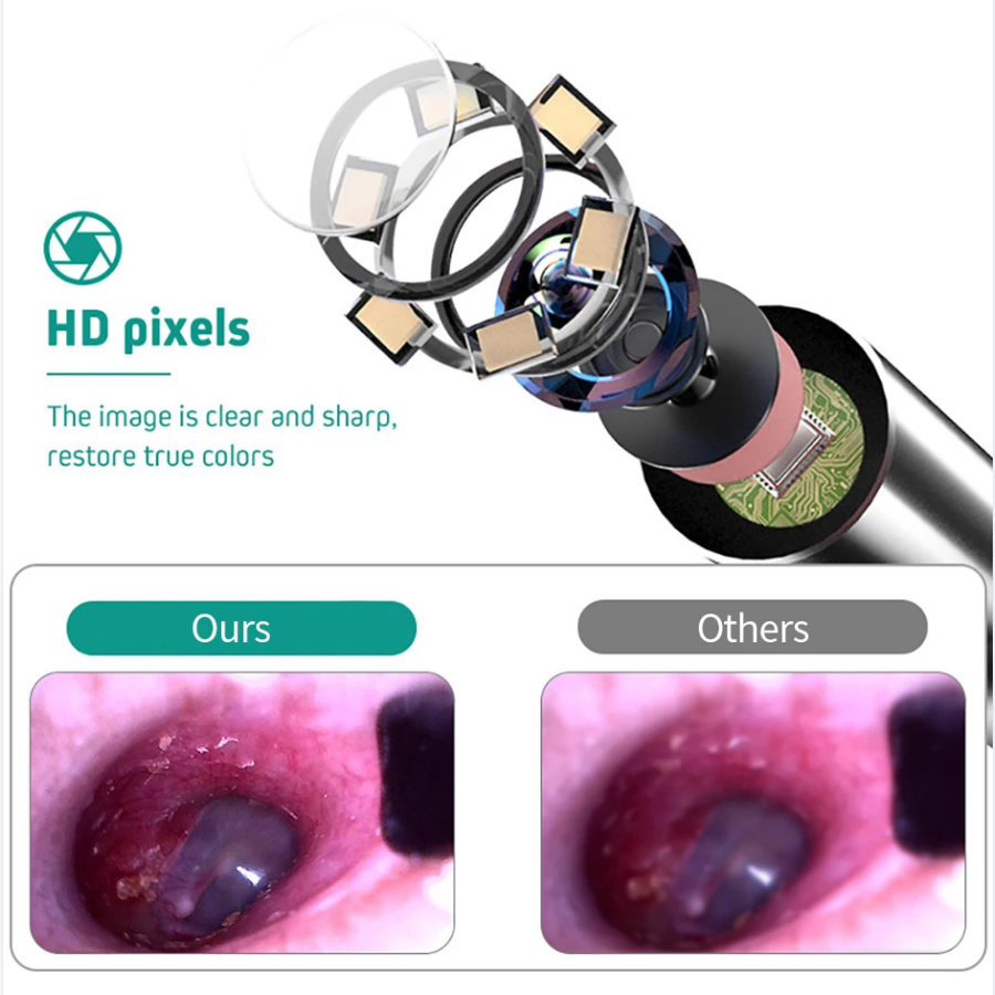【Clearance Markdowns】 HD Ear Cleaner Camera Otoscope Video In Ear ...