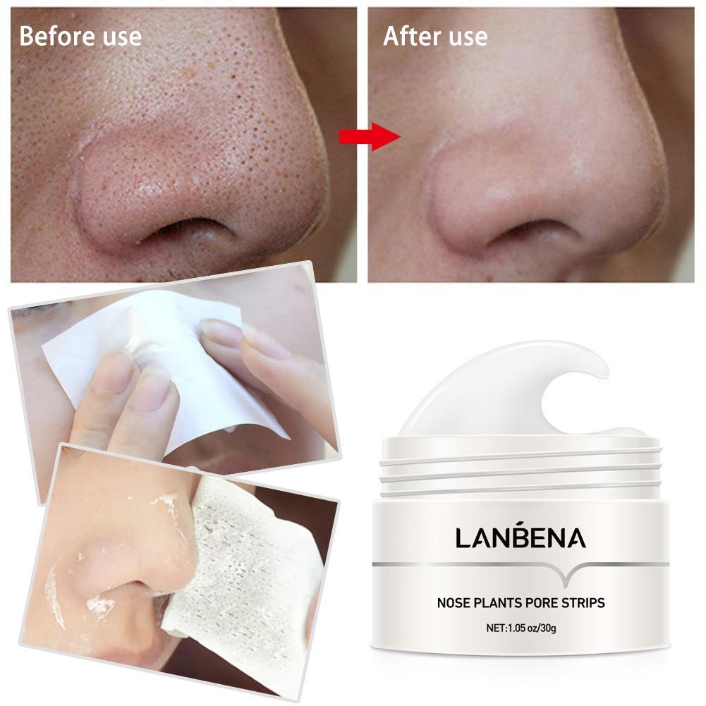 LANBENA Blackhead Remover Cream Paper Plant Pore Strips Nose Acne ...