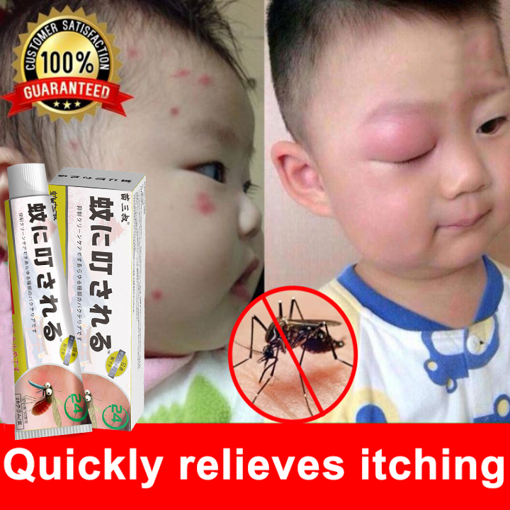 Krim Anti Gatal/ Krim Anti Nyamuk/ Mosquito Repellent Lotion/Oles ...