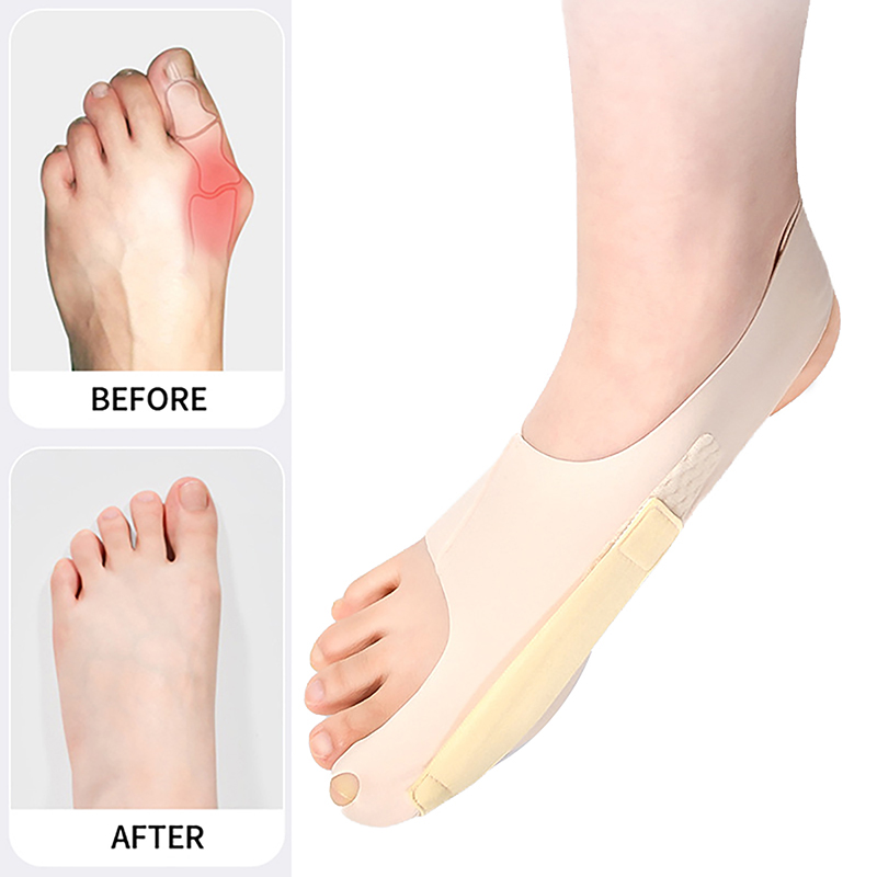 Aweisuan Hot Sale 1 Pcs Big Toe Protector Adjust Unisex Soft Pedicure ...