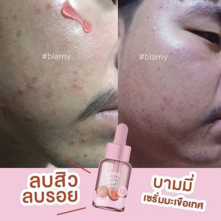 เซรั่ม มะเขือเทศ เซรั่ม นม Blamy บาล์มมี่ เซรั่มตัวดังTikTok ของแท้ ...