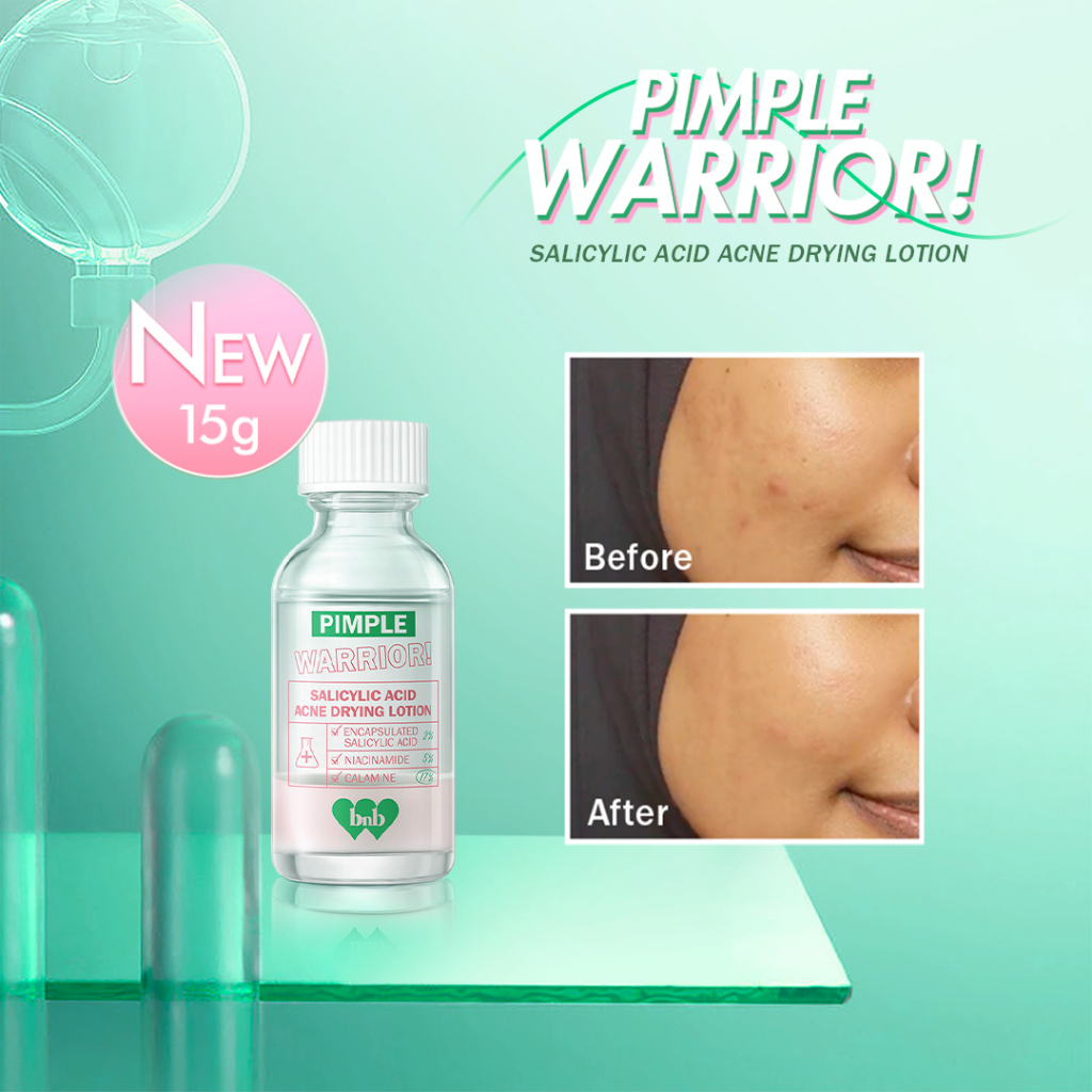 BNB barenbliss Pimple Warrior Salicylic Acid Acne Spot Treatment Drying ...